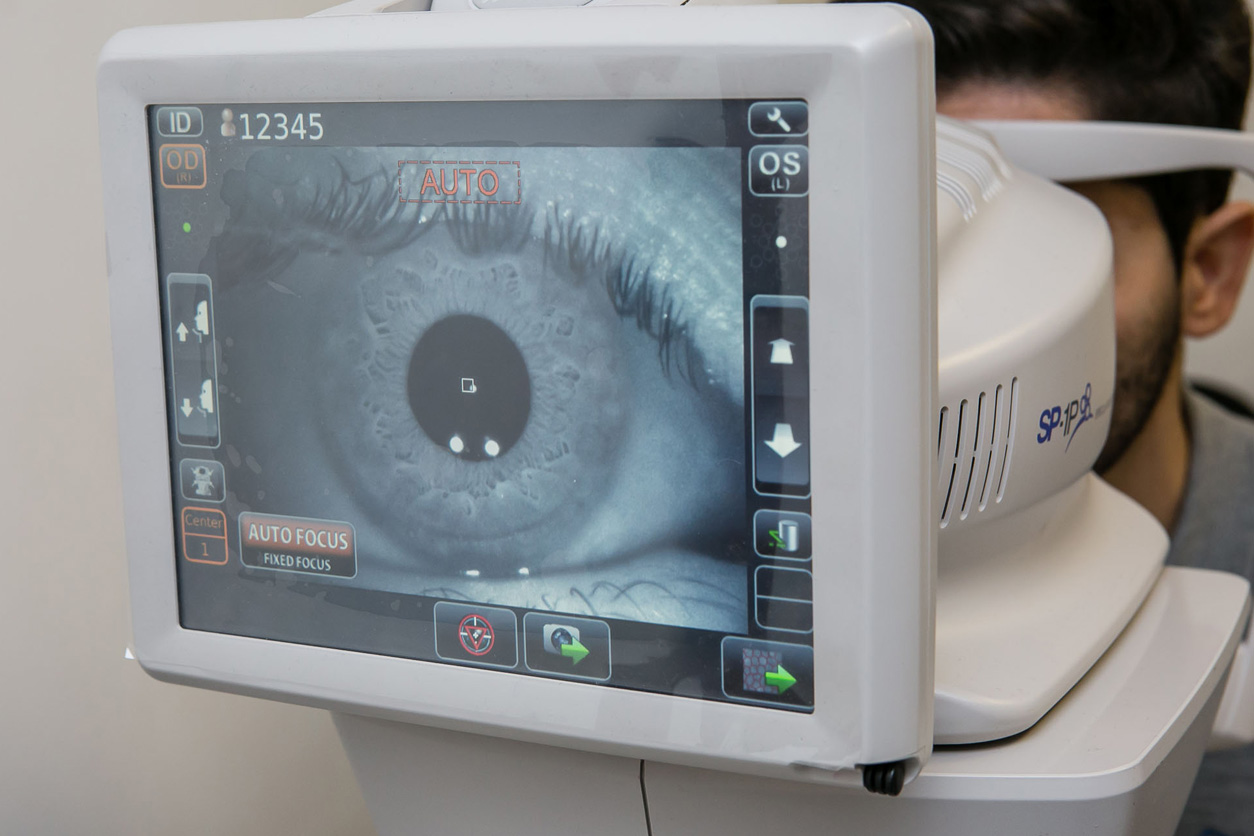 Microscopia especular de córnea - Visu Clinic